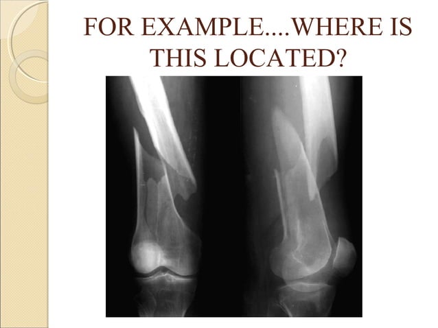 Basics of orthopedic radiology | PPT