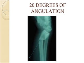 Basics of orthopedic radiology | PPT