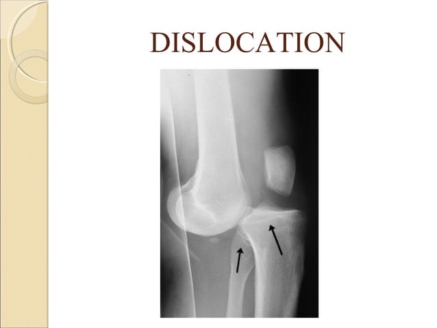 Basics of orthopedic radiology | PPT