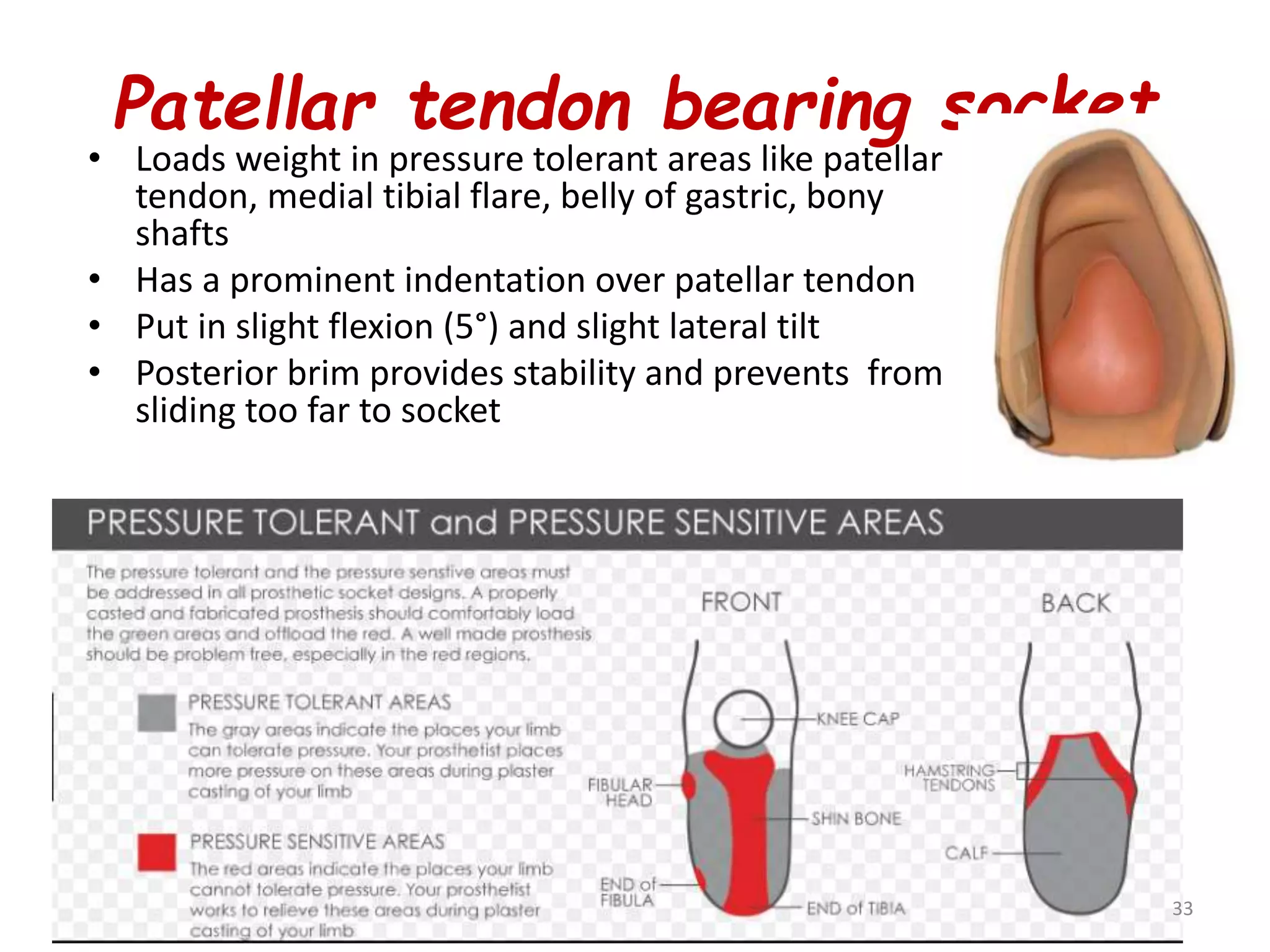 Basics of Orthosis & Prosthesis.pptx