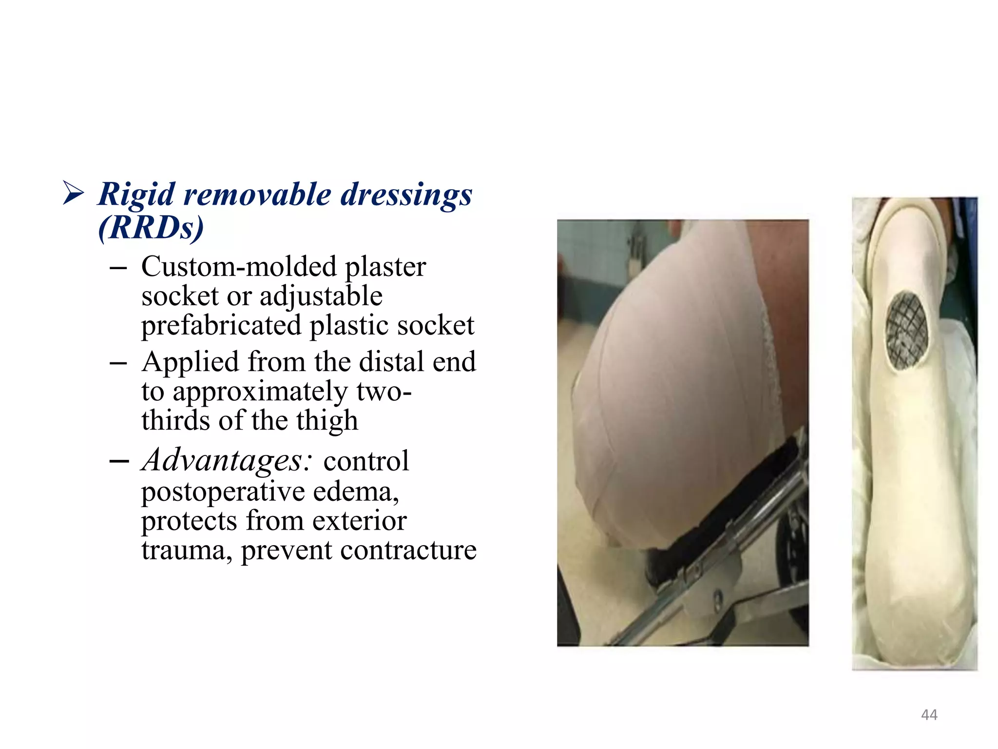 Basics of Orthosis & Prosthesis.pptx