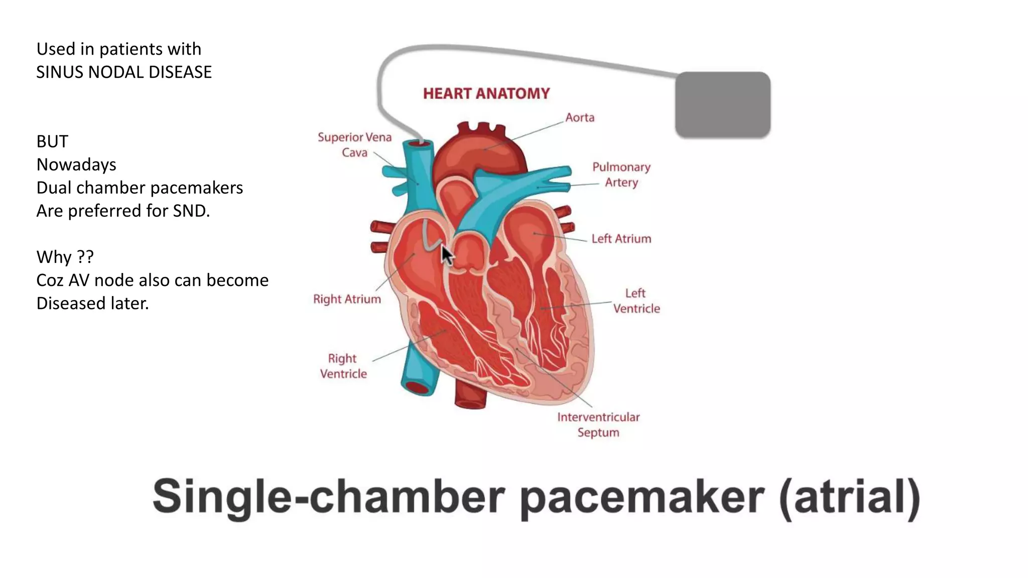 Basics of Pacemaker Dr Hafeesh Fazulu Pushpagiri | PPTX