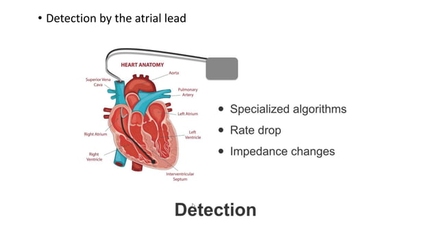 Basics of Pacemaker Dr Hafeesh Fazulu Pushpagiri | PPTX | Heart and ...