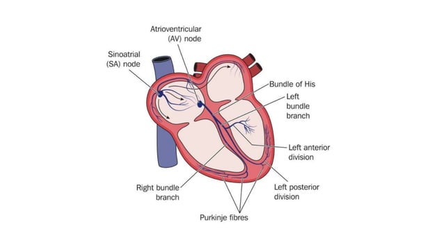 Basics of Pacemaker Dr Hafeesh Fazulu Pushpagiri | PPTX | Heart and ...