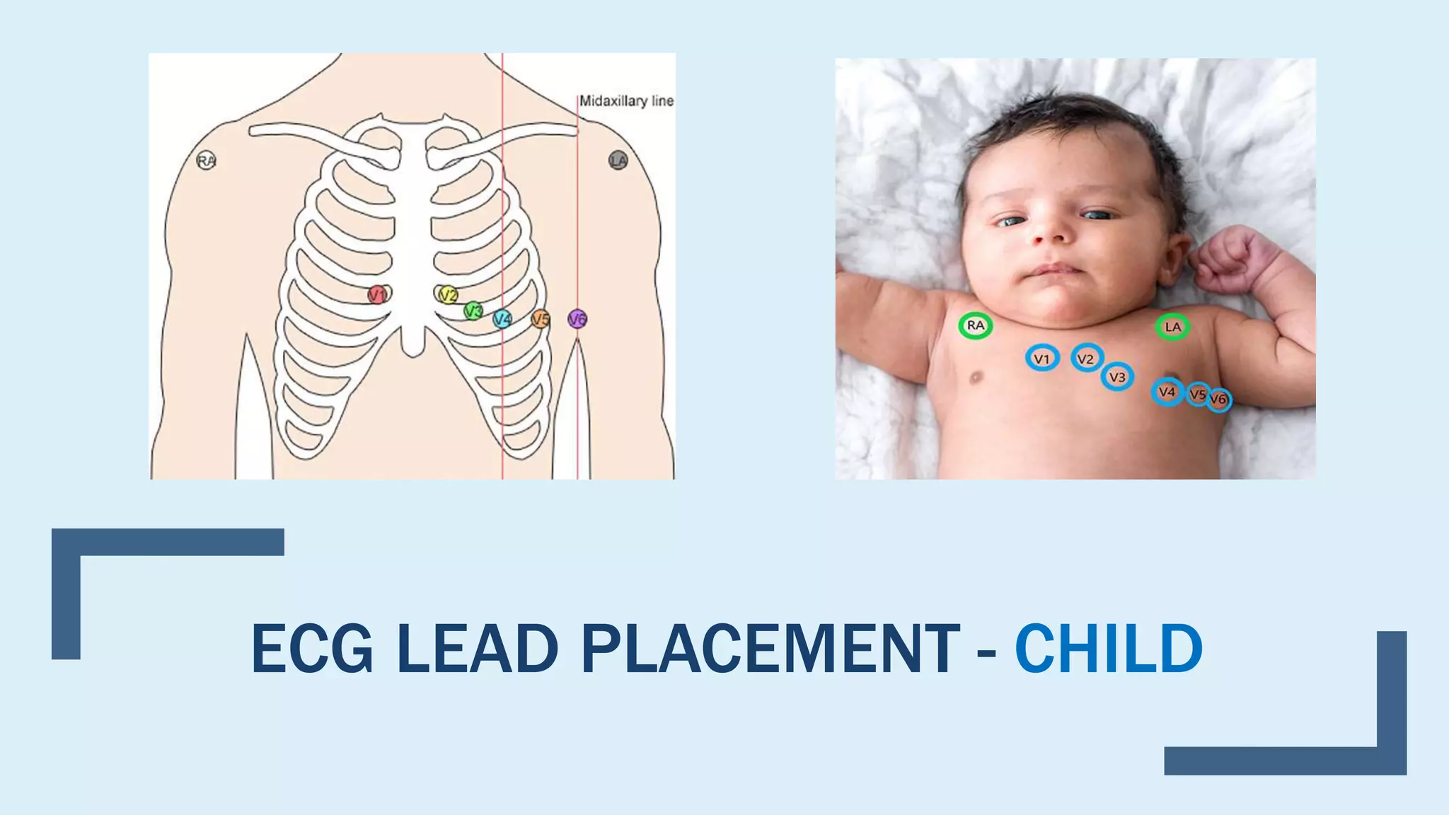 Basics Of Paediatric ECG PPTX