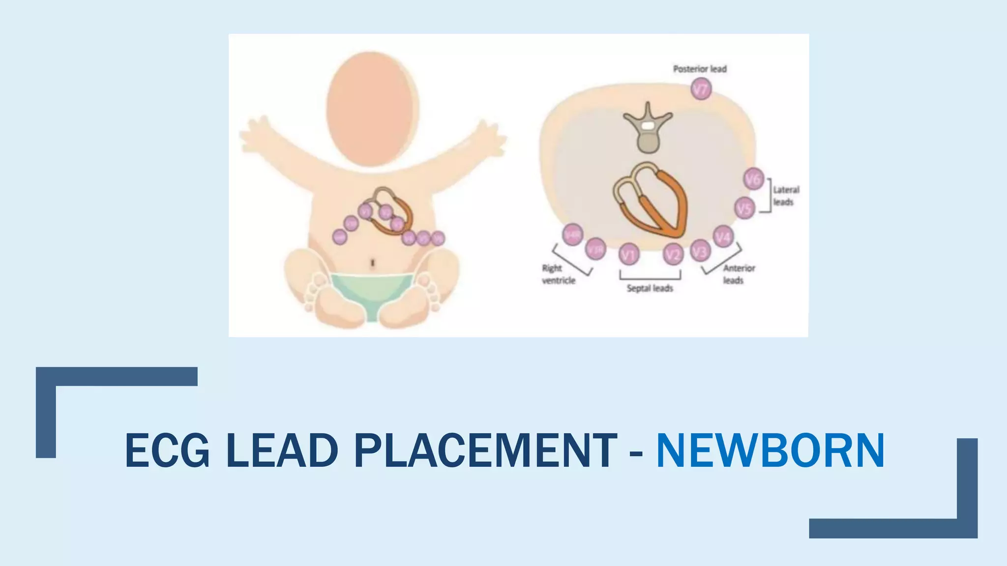 Basics of Paediatric ECG | PPTX