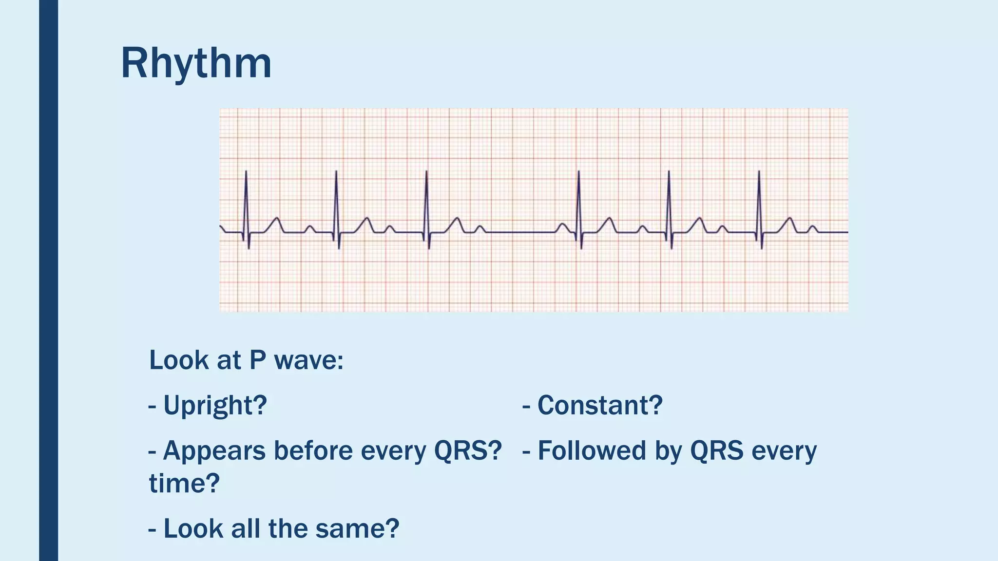 Basics of Paediatric ECG | PPTX