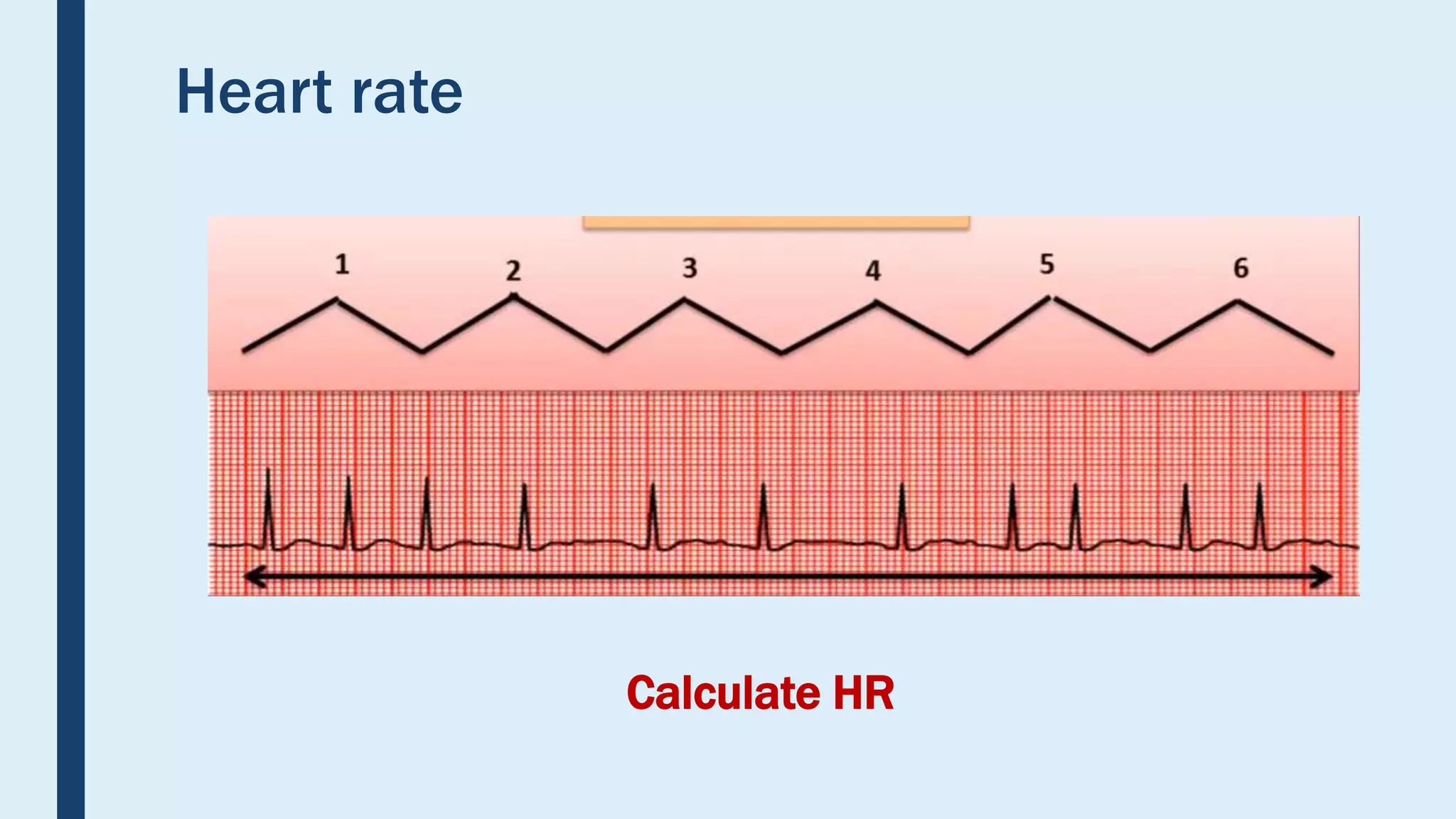 Basics of Paediatric ECG | PPTX