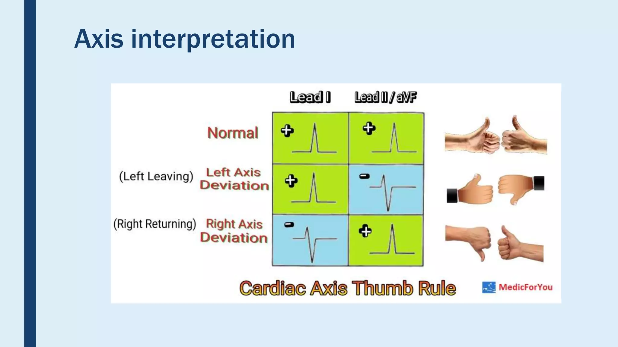 Basics of Paediatric ECG | PPTX