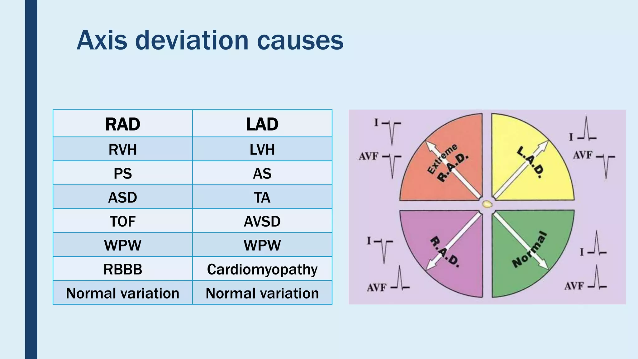 Basics of Paediatric ECG | PPTX