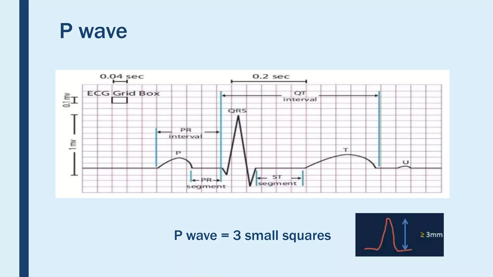Basics of Paediatric ECG | PPTX