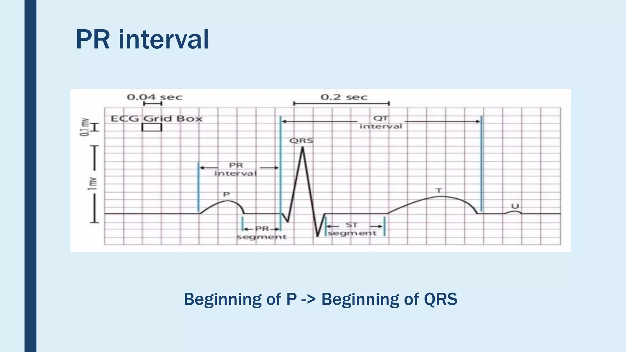 Basics of Paediatric ECG | PPTX