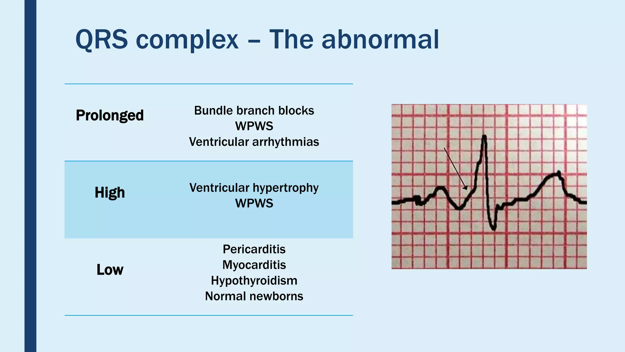 Basics of Paediatric ECG | PPTX