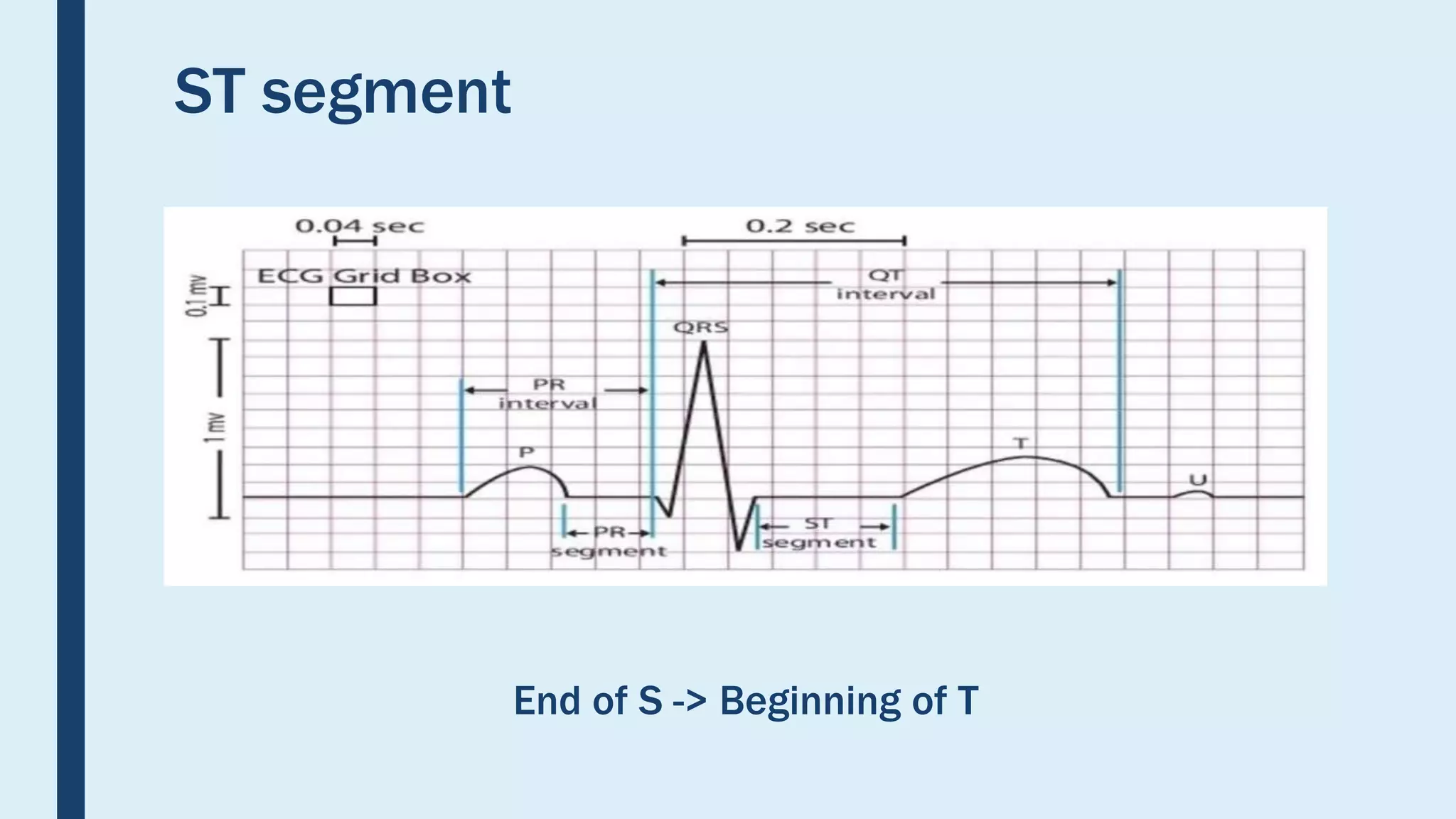 Basics of Paediatric ECG | PPTX