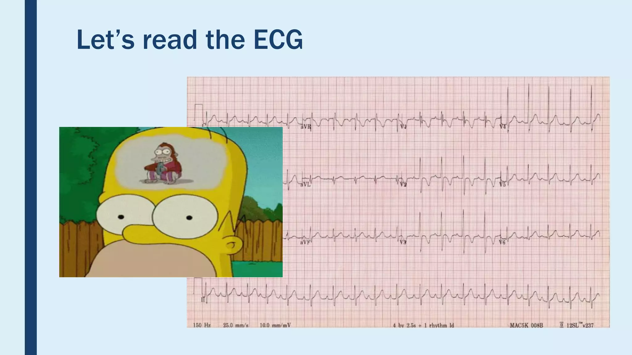Basics of Paediatric ECG | PPTX