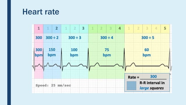 Basics of Paediatric ECG | PPTX