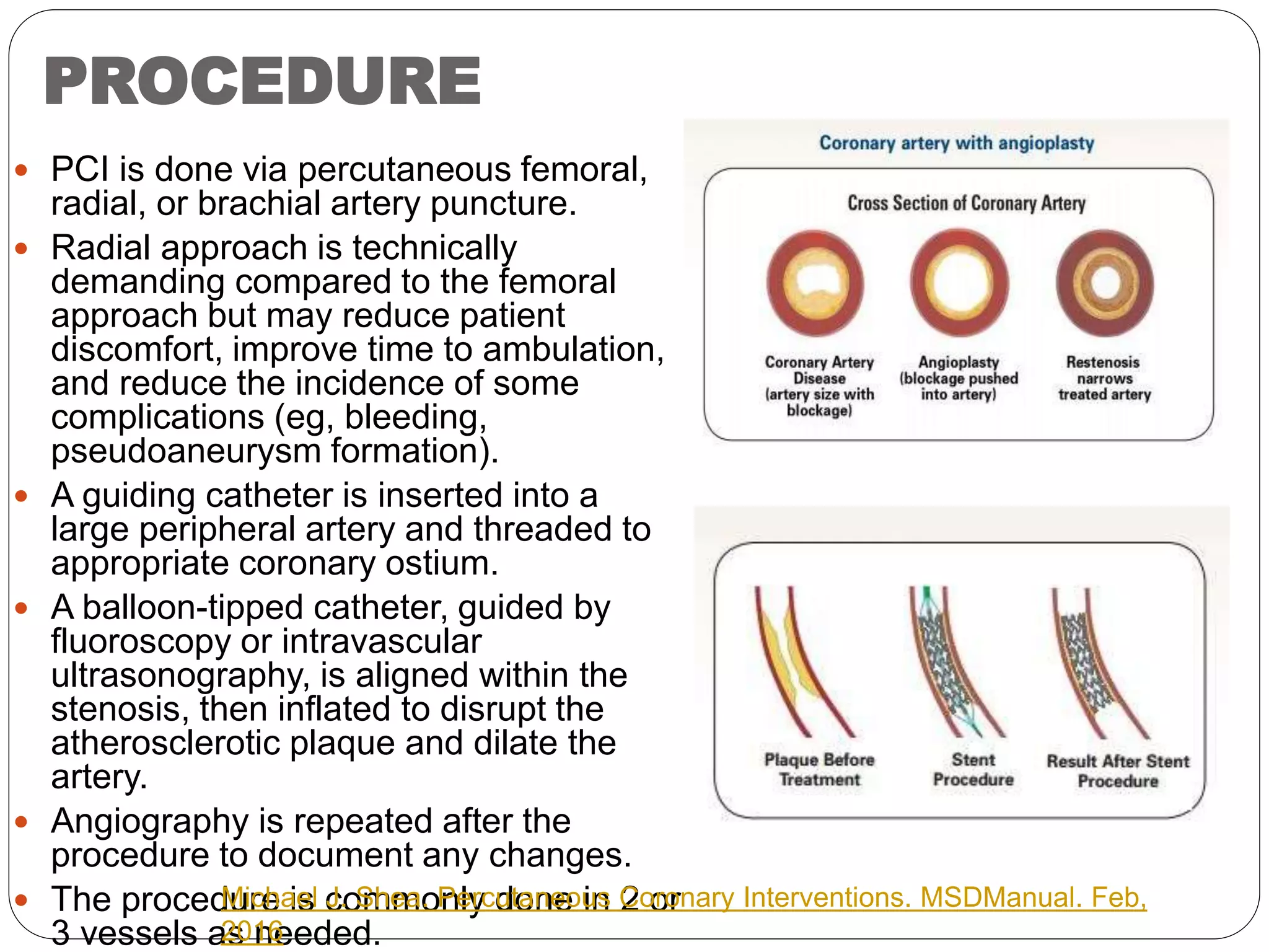 Basics of pci | PPTX