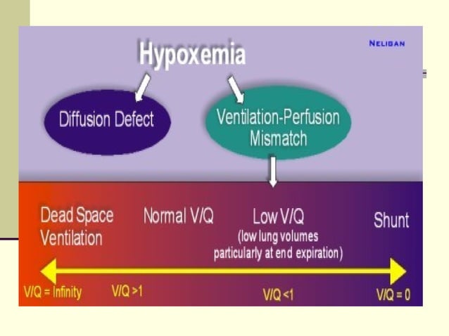 Basics of pediatric ventilation | PPT | Lung and Respiratory Health ...
