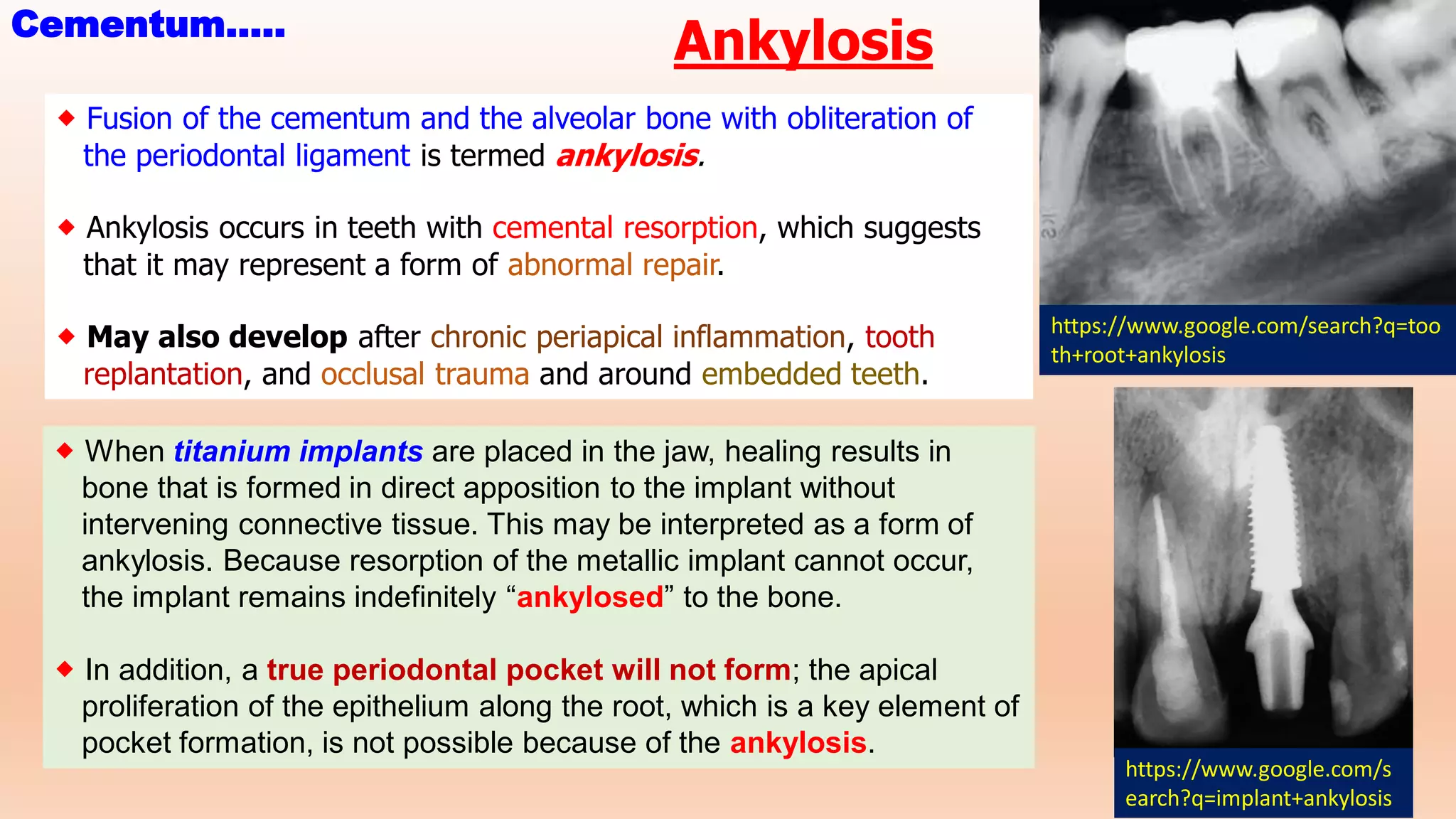 Basics of periodontology diagnosis and treatment | PDF