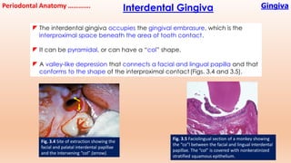 Basics of periodontology diagnosis and treatment | PDF