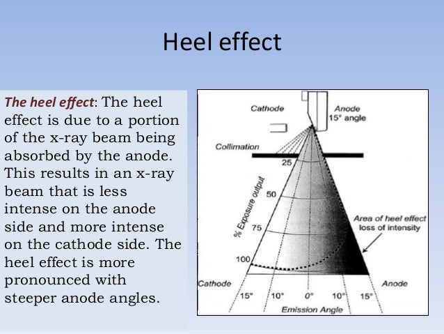 Basics of radiation and production of x rays