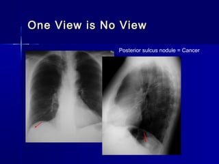 Basics of radiology | PPT