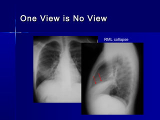 Basics of radiology | PPT