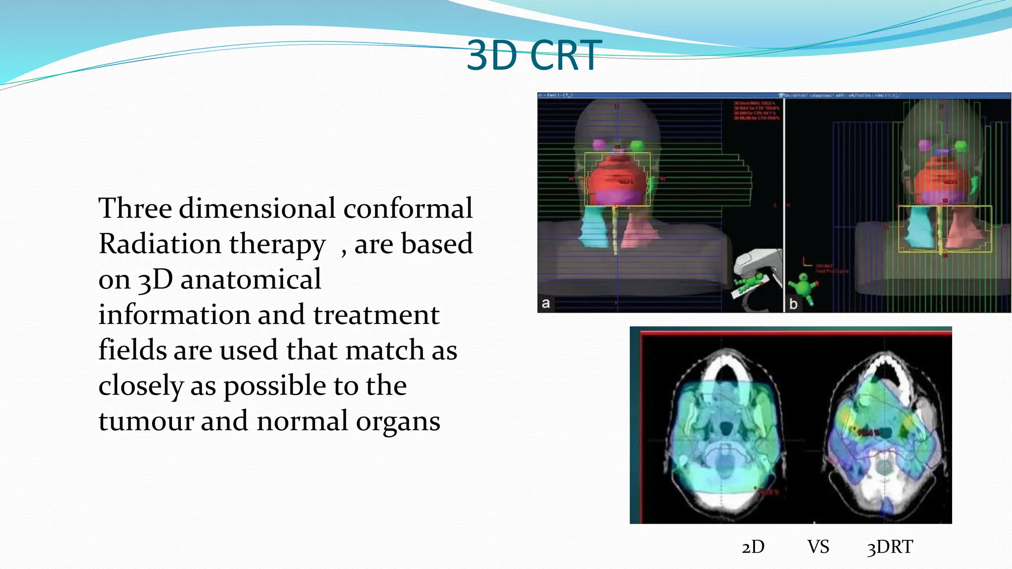 BASICS OF RADIATION THERAPY/RADIATION ONCOLOGY | PPTX