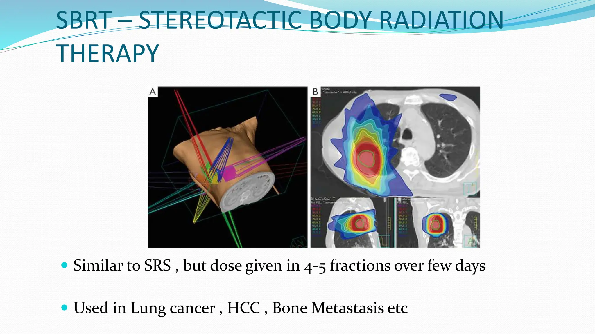 BASICS OF RADIATION THERAPY/RADIATION ONCOLOGY | PPTX
