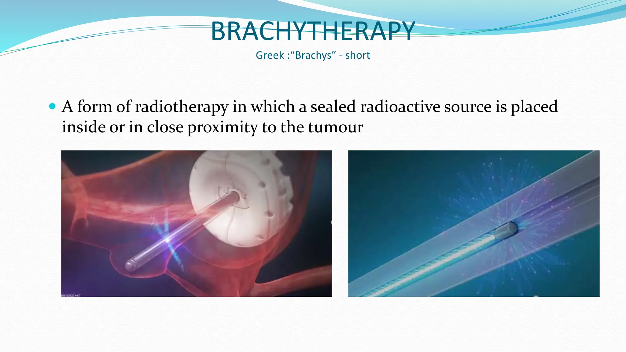 BASICS OF RADIATION THERAPY/RADIATION ONCOLOGY | PPTX