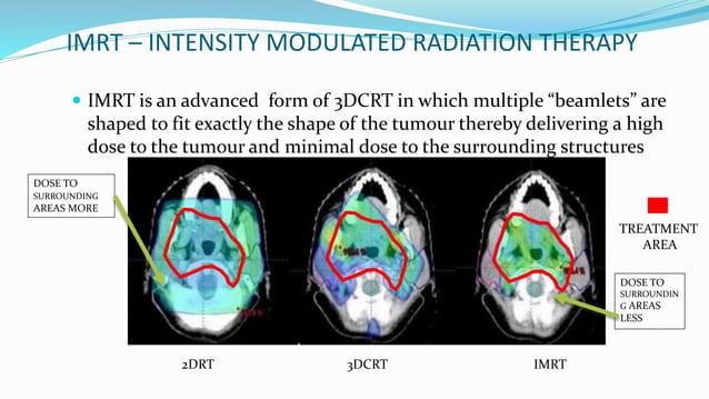 BASICS OF RADIATION THERAPY/RADIATION ONCOLOGY | PPTX | Cancer ...