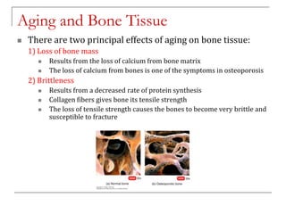 Basics of skeletal system | PPTX