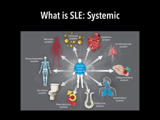Basics of SLE | PPT
