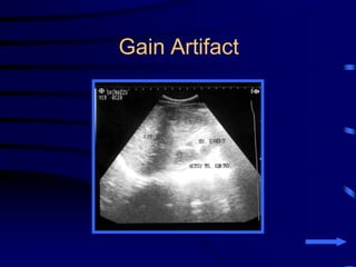 Sudanese Chest Sonography Workshop (Basics of sonography and anatomy of ...