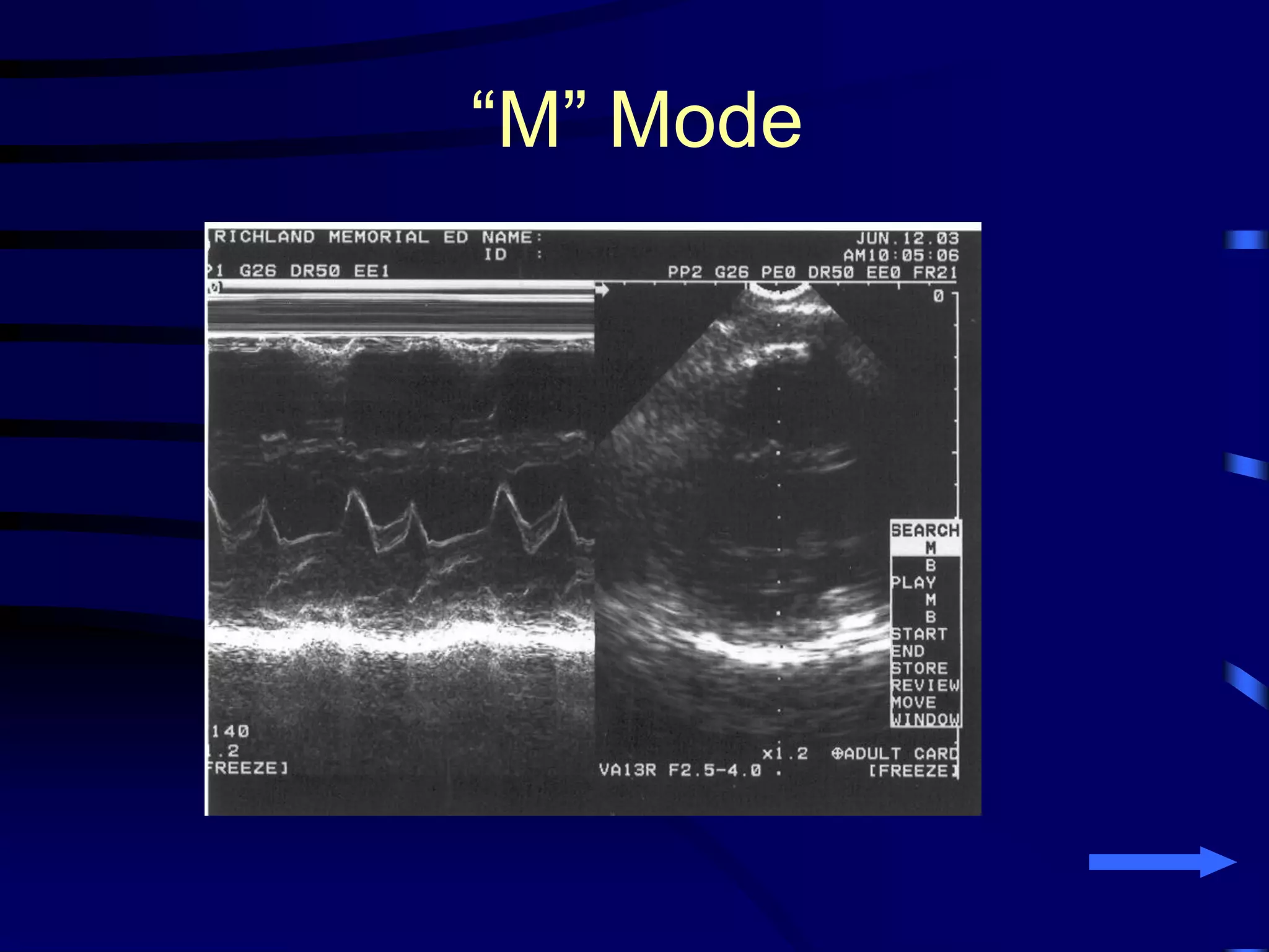 Basics of Chest Sonography and Anatomy of Chest Wall | PDF | Lung and ...