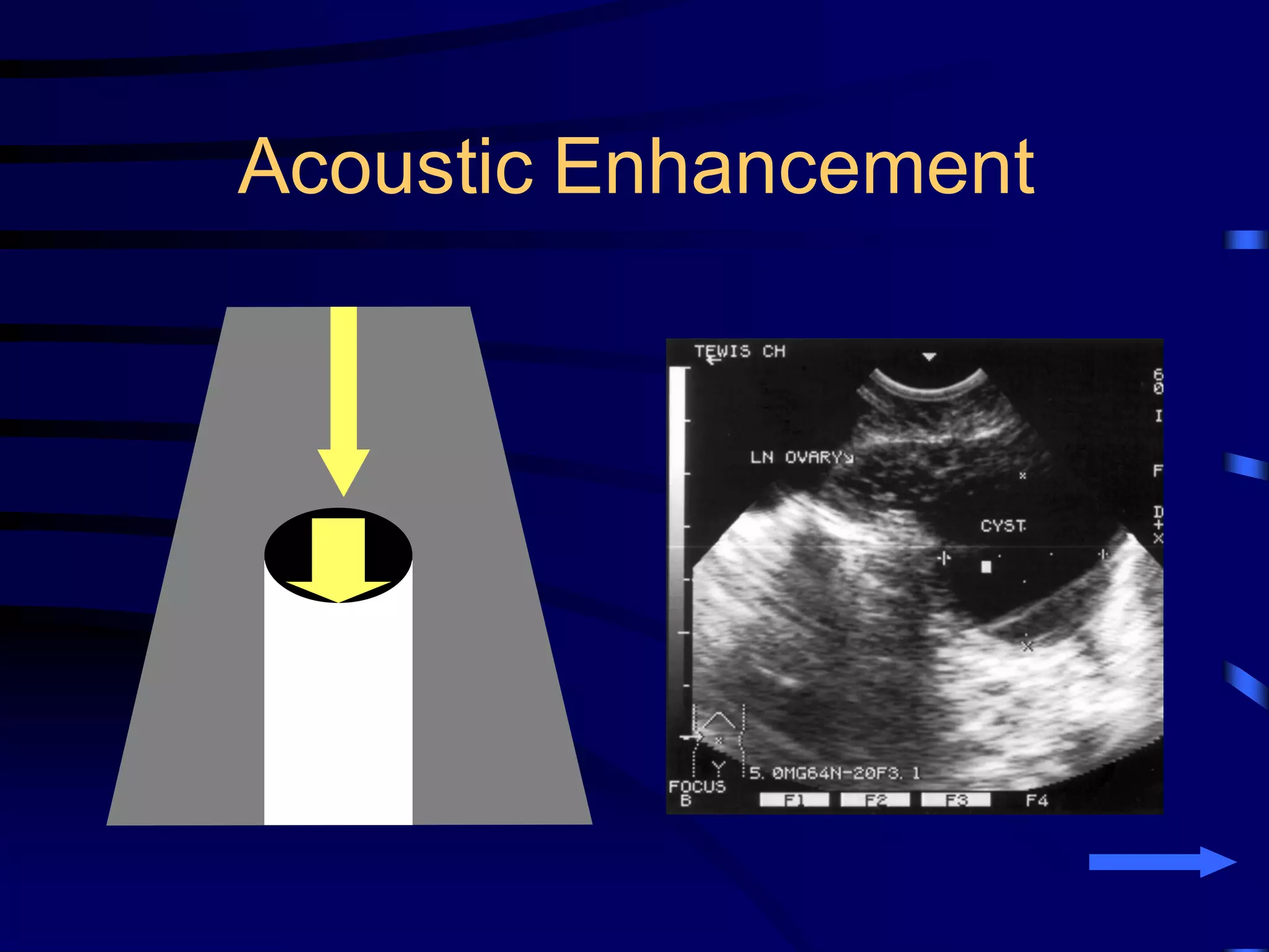 Basics of Chest Sonography and Anatomy of Chest Wall | PDF | Lung and ...