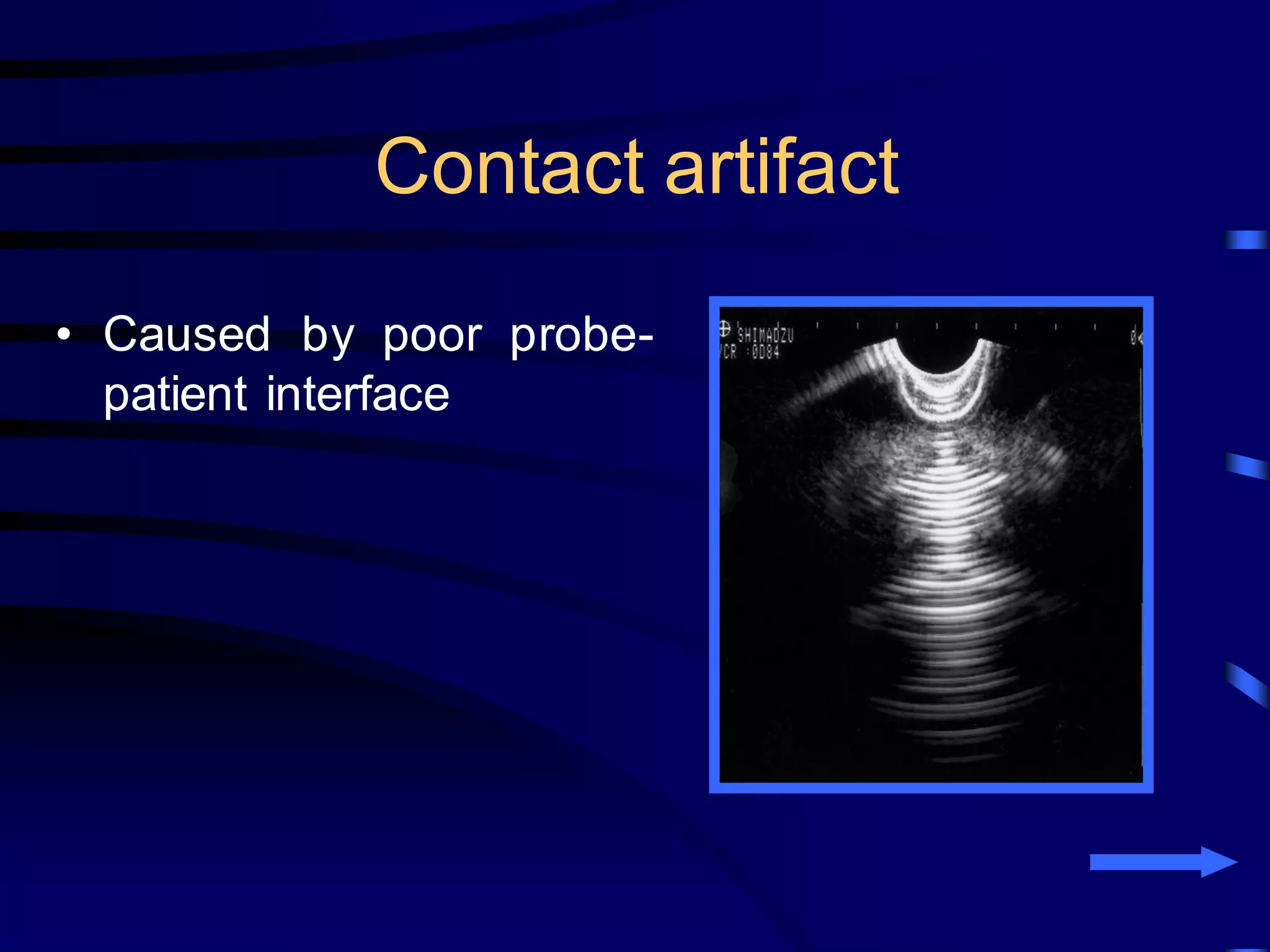 Basics of Chest Sonography and Anatomy of Chest Wall | PDF | Lung and ...