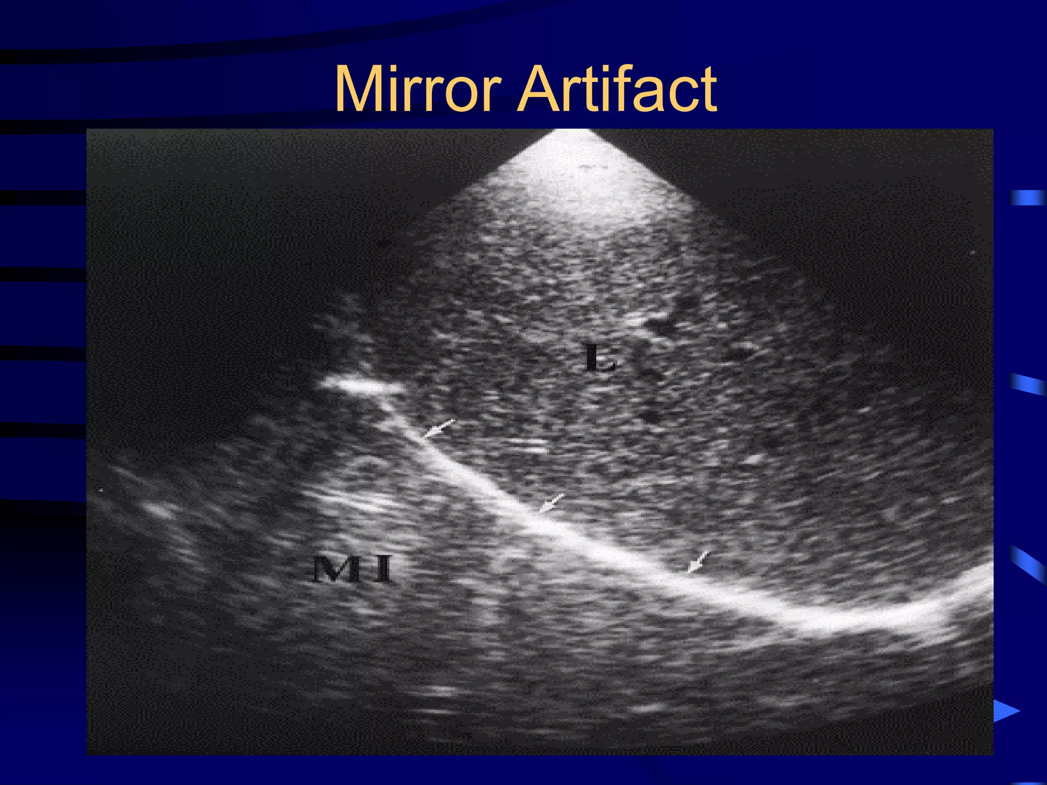 Basics of Chest Sonography and Anatomy of Chest Wall | PDF | Lung and ...