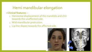 BASICS OF Temporomandibular joint..ppttt | PPTX