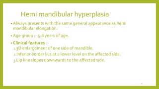 BASICS OF Temporomandibular joint..ppttt | PPTX