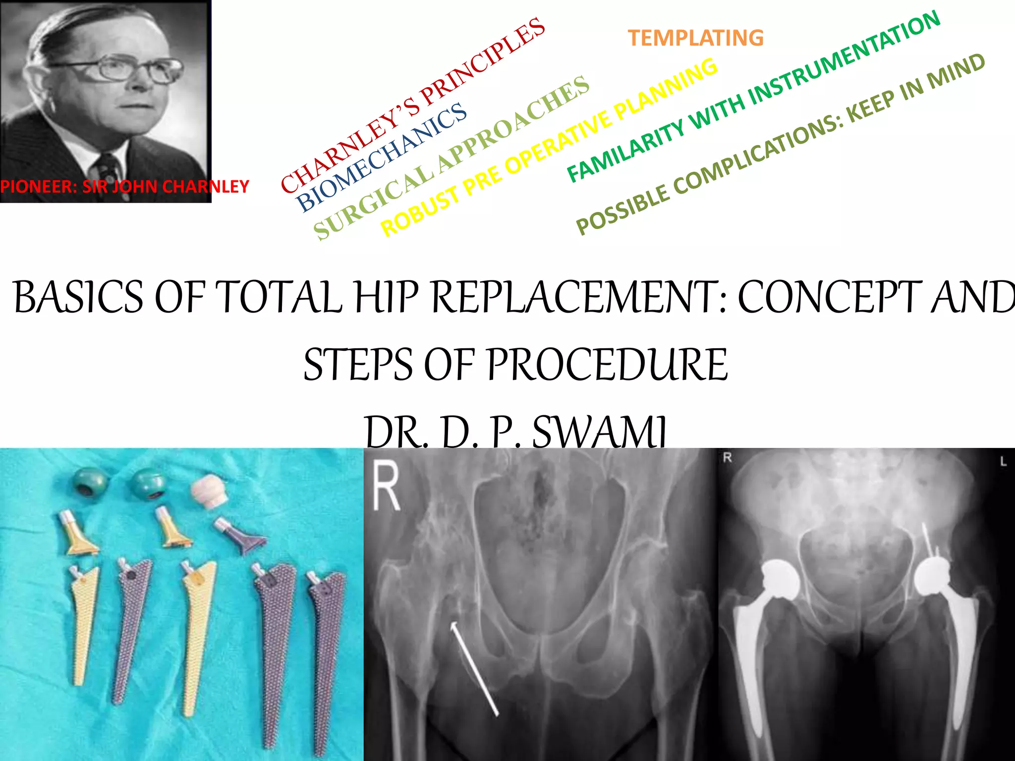 Basics of total hip replacement by DR. D. P. SWAMI | PPTX