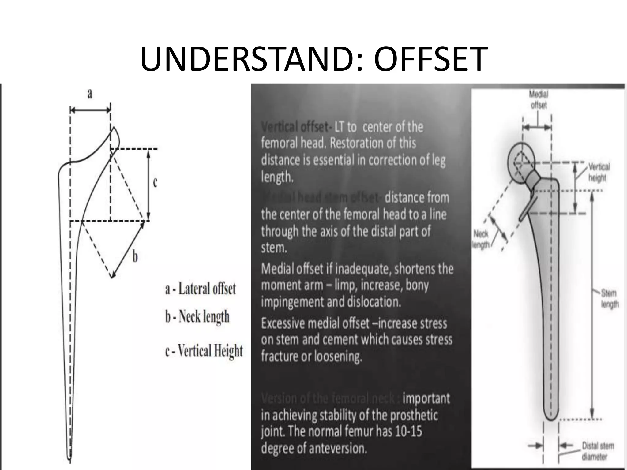 Basics of total hip replacement by DR. D. P. SWAMI | PPTX