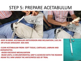 Basics of total hip replacement by DR. D. P. SWAMI | PPTX