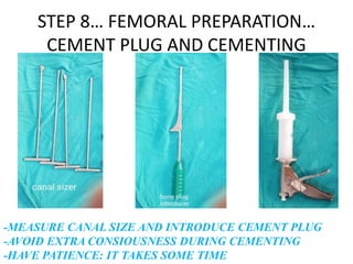Basics of total hip replacement by DR. D. P. SWAMI | PPTX