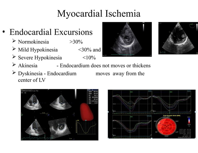 BASICS OF TTE trans tracheal echo& TEE.pptx