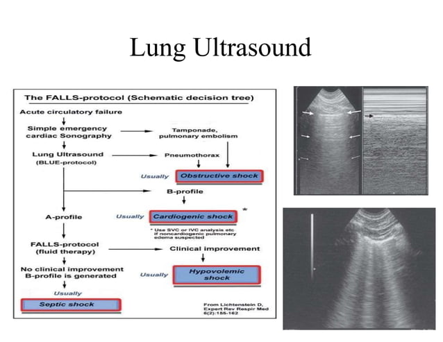 BASICS OF TTE trans tracheal echo& TEE.pptx