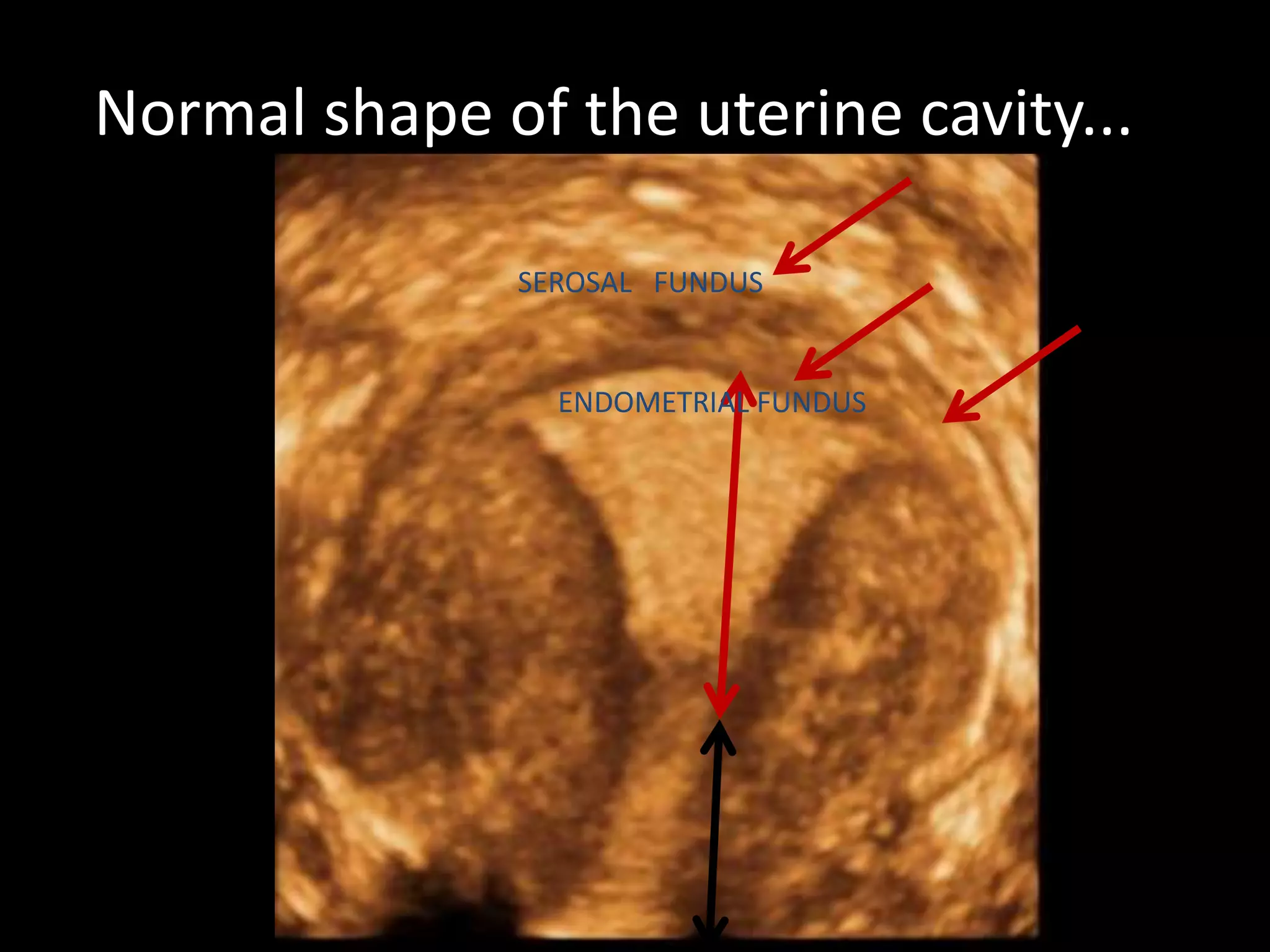 Basics of tvs color doppler | PPTX