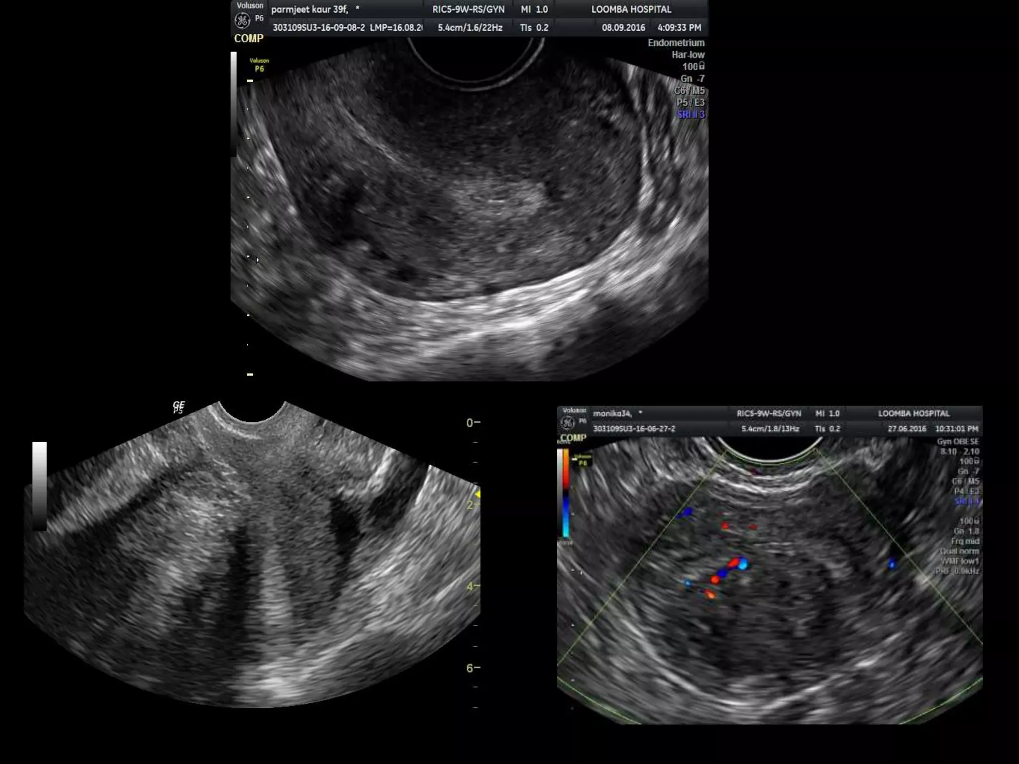 Basics of tvs color doppler | PPTX