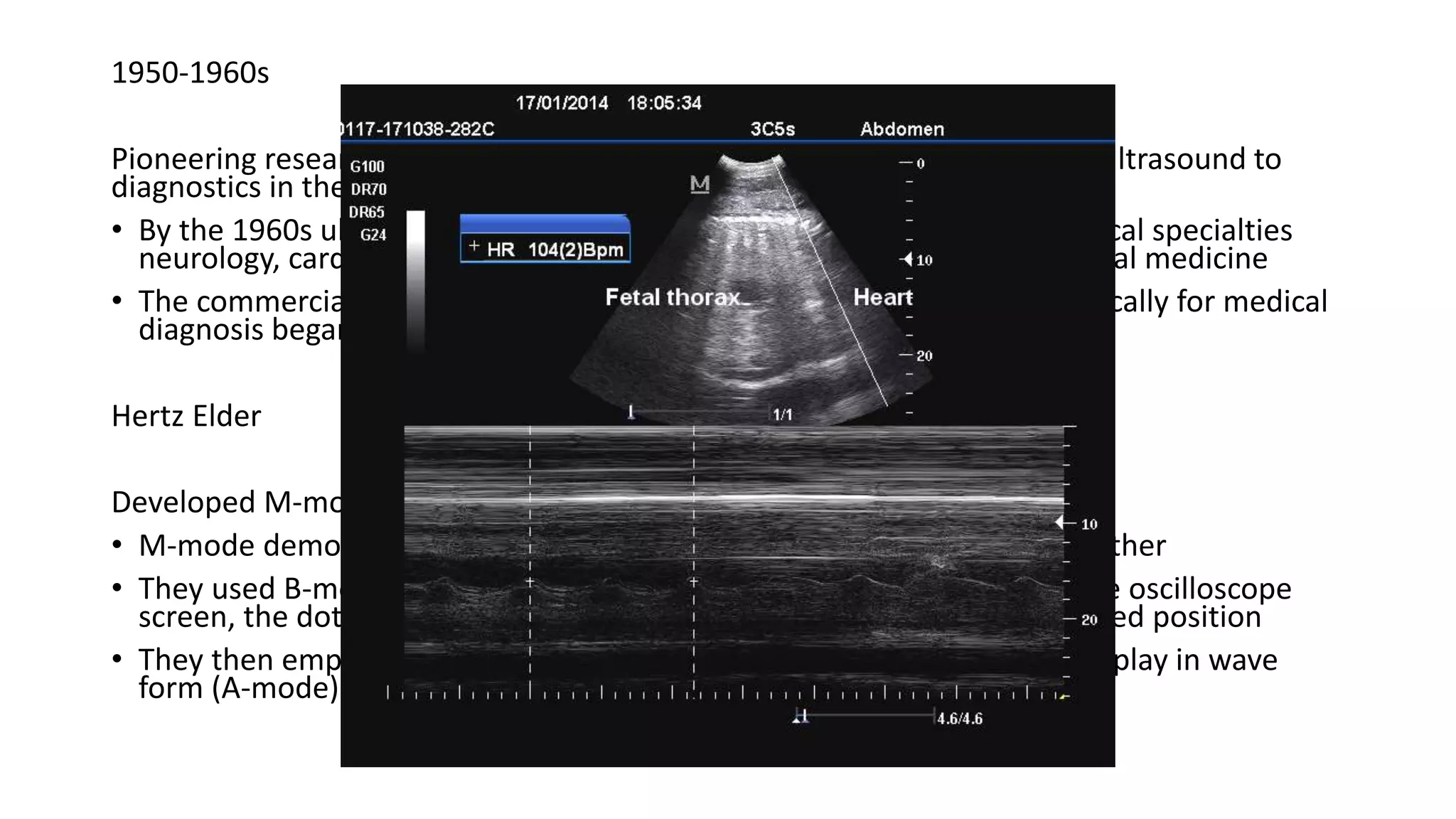 Basics of Ultrasound.pptx