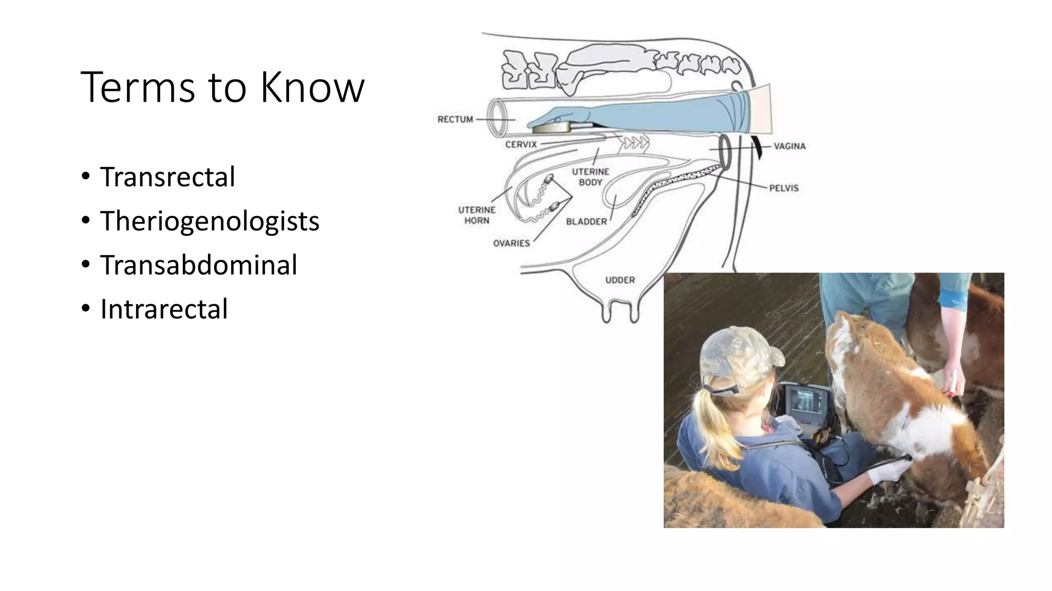 Basics of Ultrasound.pptx